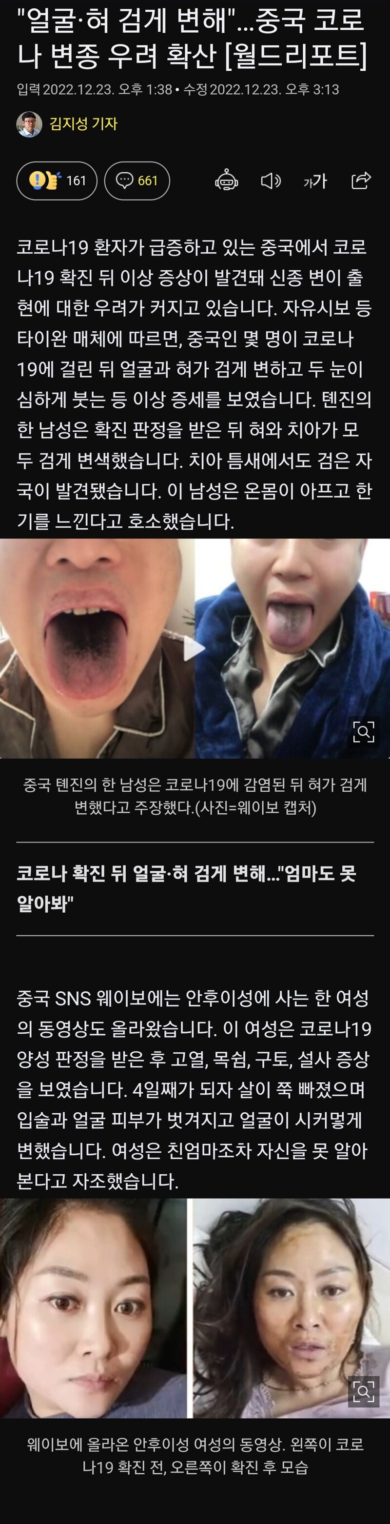 얼굴·혀 검게 변해중국 코로나 변종 우려 확산 오픈이슈갤러리 인벤