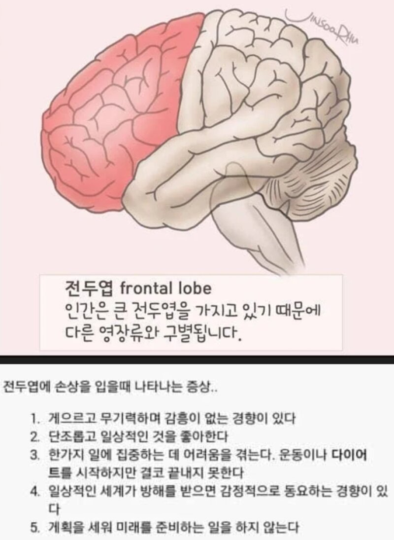 메이플스토리 인벤 우리 메벤에는 전두엽 손상된 사람 없지 메이플스토리 인벤 자유게시판