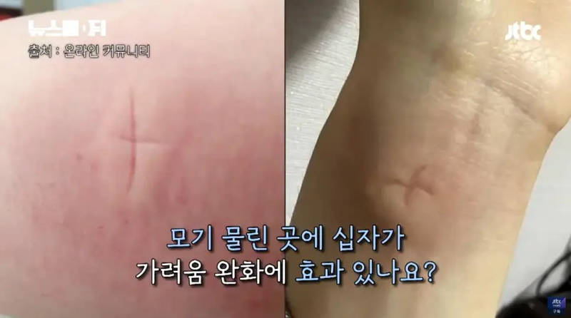 모기물렸을때 십자가 찍기 효과 있을까 오픈이슈갤러리 인벤