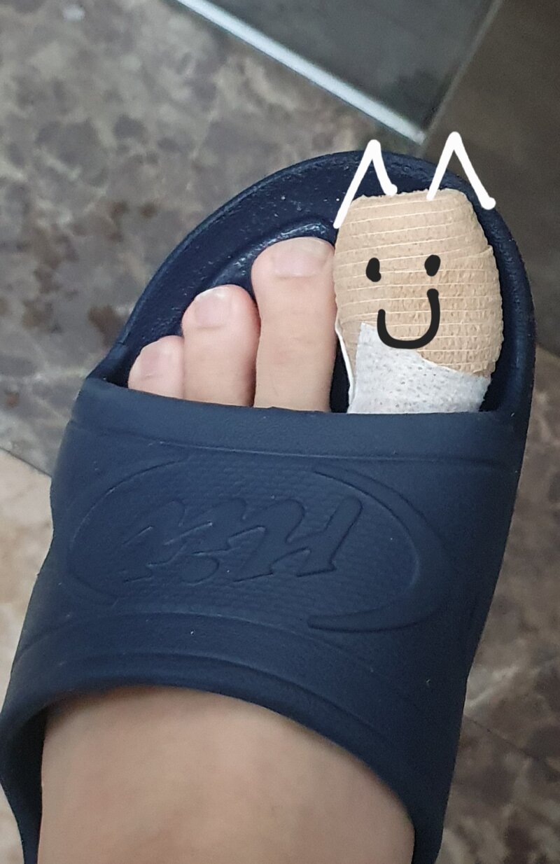 메이플스토리 인벤 약혐 발톱 피멍뺐다 메이플스토리 인벤 자유게시판