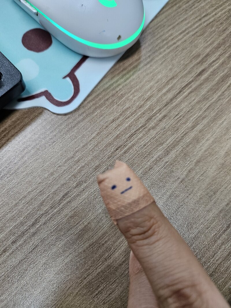 메이플스토리 인벤 손톱 빠졌어서 밴드 붙였어 메이플스토리 인벤 자유게시판