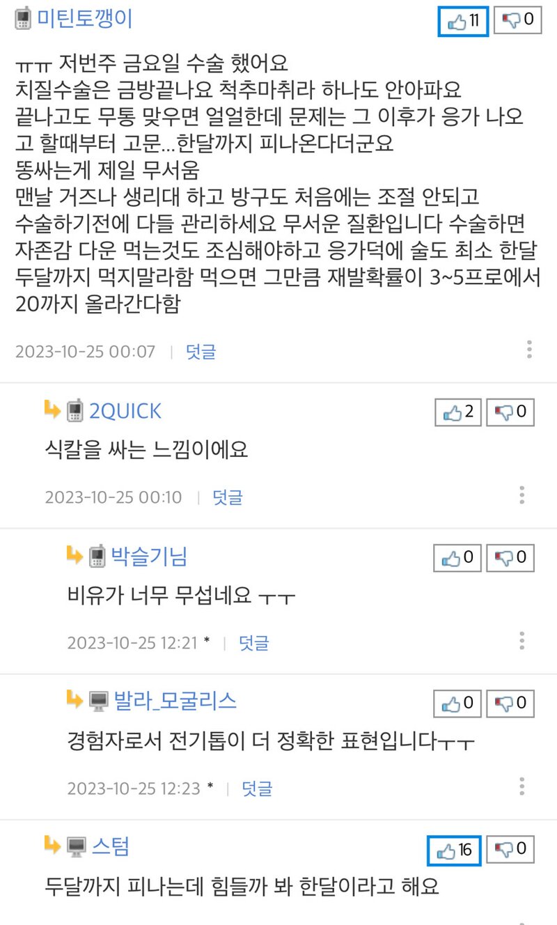 치질 수술할 때 쓰는 기계 Vortex Gaming