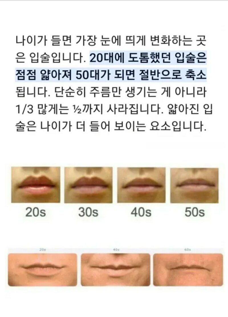 로스트아크 인벤 나이들면 제일 크게 변하는 신체부위ㅁㅊ 로스트아크 인벤 자유 게시판구
