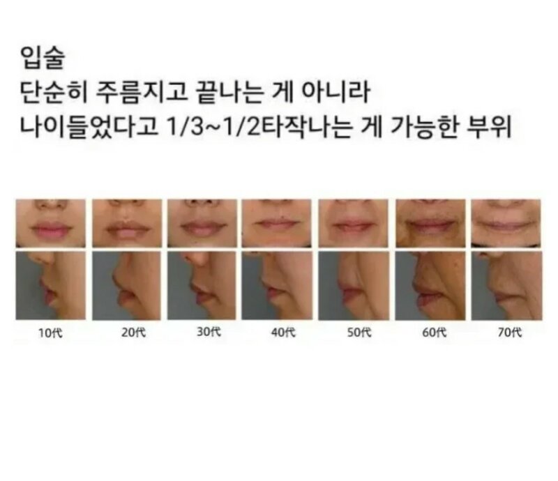 로스트아크 인벤 나이들면 제일 크게 변하는 신체부위ㅁㅊ 로스트아크 인벤 자유 게시판구
