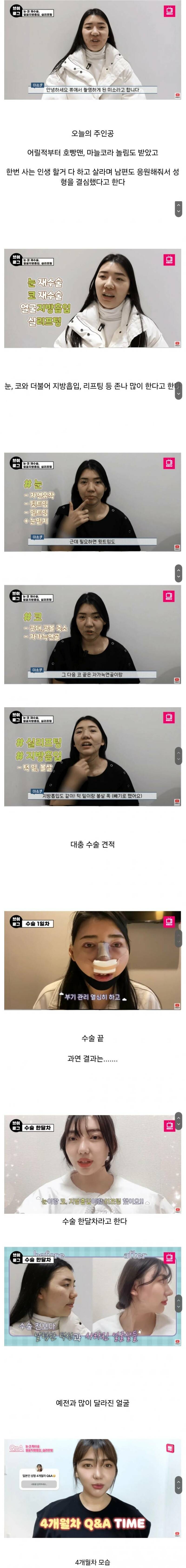 한국에서 성형수술 받고 간 일본 눈나 Vortex Gaming