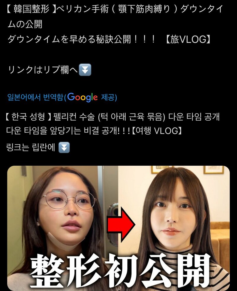 오픈 이슈 갤러리 얼마전 한국와서 성형수술한 Av여배우 Vortex Gaming