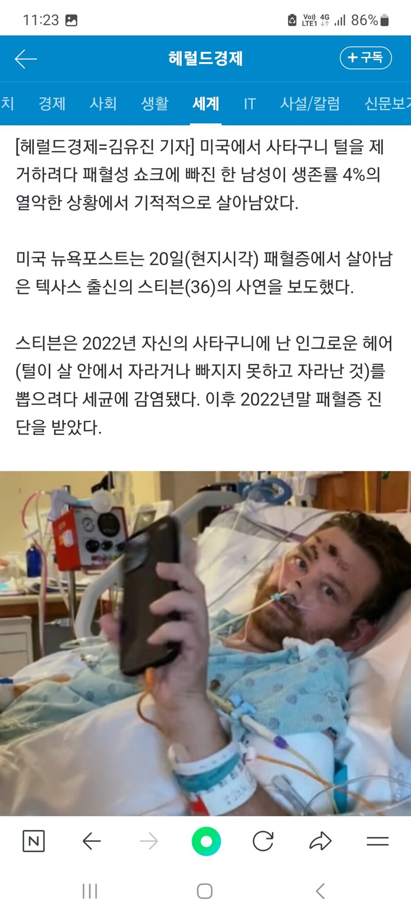메이플스토리 인벤 꼬추털 함부로 뽑으면 안되는 이유 메이플스토리 인벤 자유게시판